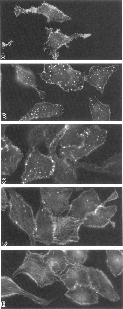 Wortmannin Does Not Block Antigen Induced Actin Plaque Assembly Or