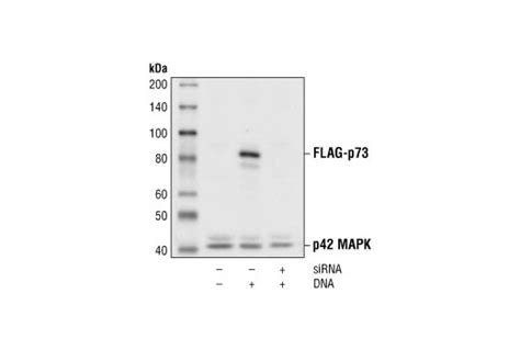 Signalsilence® P73 Sirna Cell Signaling Technology