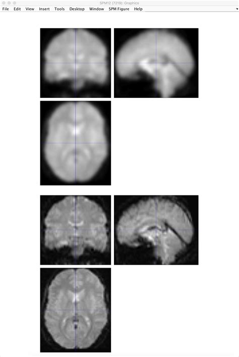 chapter 6 smoothing — andy s brain book 1 0 documentation