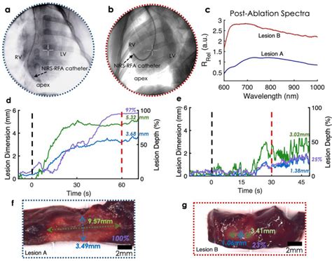 Quantification Of Irrigated Lesion Morphology Using Near Infrared