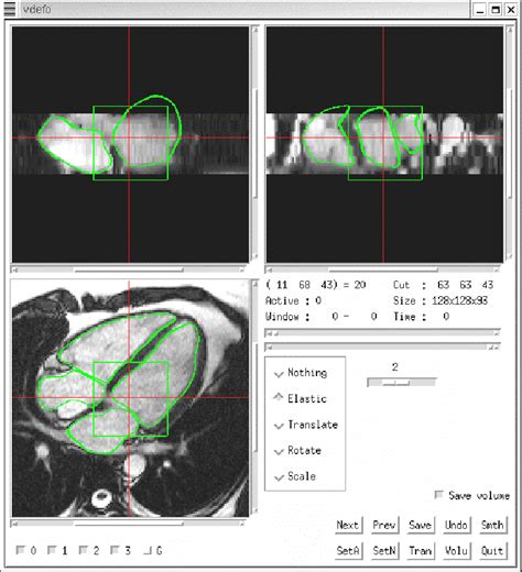 a software tool for manual segmentation download scientific diagram