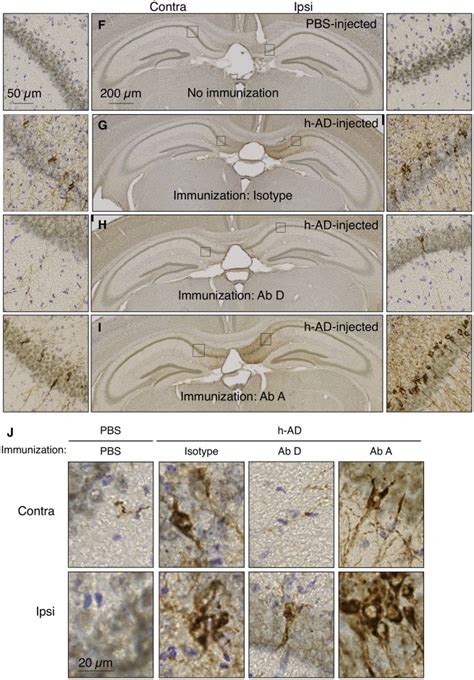 Prevention Of Tau Seeding And Propagation By Immunotherapy With A