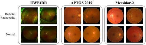 [논문 리뷰] Efficient Deep Learning Approaches For Processing Ultra Widefield Retinal Imaging