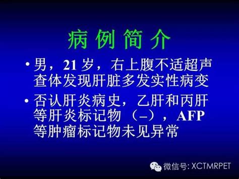 PPT肝脏FNH少见MRI表现与诊断 影像PPT