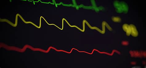 Starting Your Qa Journey 10 Lessons Every New Software Tester Should Know By Testify Medium