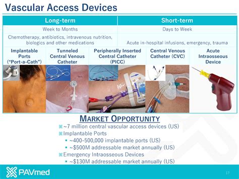Types Of Venous Access Devices