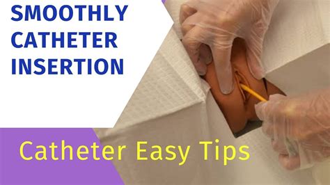Indwelling Urinary Catheter Insertion Female At Stefanie Roman Blog