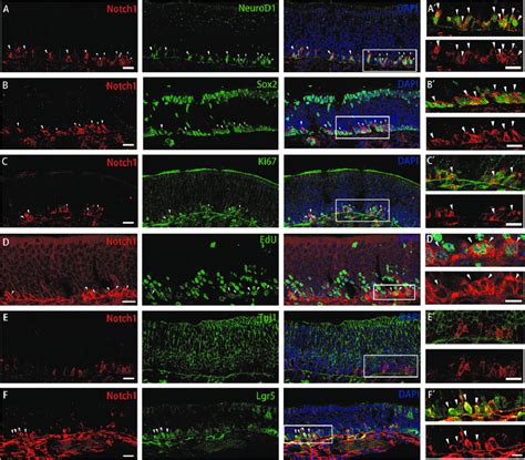Notch1 Cells Are Proliferating Progenitor Cells Notch1 Cells In Download Scientific