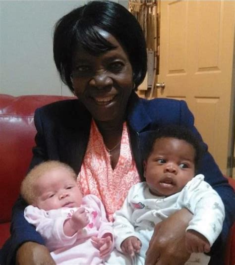 As They Grew Up Identical Twins With Varying Skin Tones Grew Apart From One Another Beaware