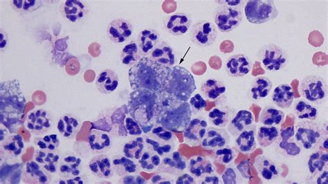 Cocci Archives Eclinpath