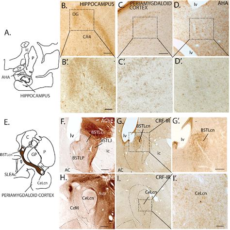 Figure 2 From The Neuroanatomic Complexity Of The Crf And Da Systems