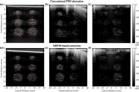 Figure 4 From Fast Marching Phase Aberration Correction In Plane Wave