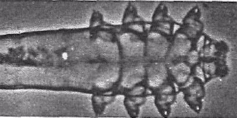 Tiny Demodex Mites Live On Most Peoples Faces Business Insider