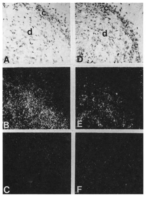 In Situ Hybridization Photomicrographs Of Representative Preterm 28 37