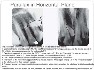 Panoramic Radiography Dental Panoramic Tomography Dpt And Periapical