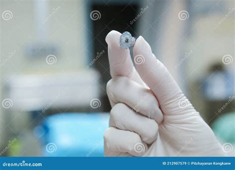 Patent Ductus Arteriosus Disease Pda Device Closure Stock Image Image Of Aortography Cardiac
