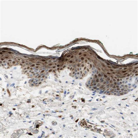 Rabbit Polyclonal Anti S100a9 Antibody Buy For Research Highly