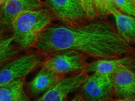 What Stops Cancer Cells From Growing Key Insights Natural Defenses