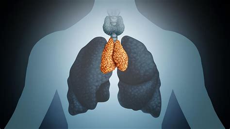 40 Facts About Thymoma And Thymic Carcinoma