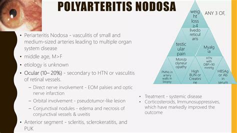 Peripheral Corneal Diseases Pptx