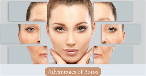 Botox Bliss Unlocking The Marvelous Advantages Skinclinicpk