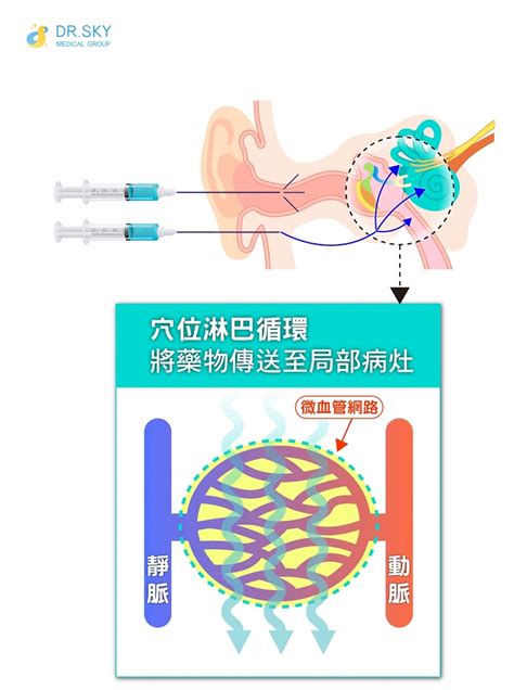 你所不知道的耳鳴與重聽 Drsky 名冠診所