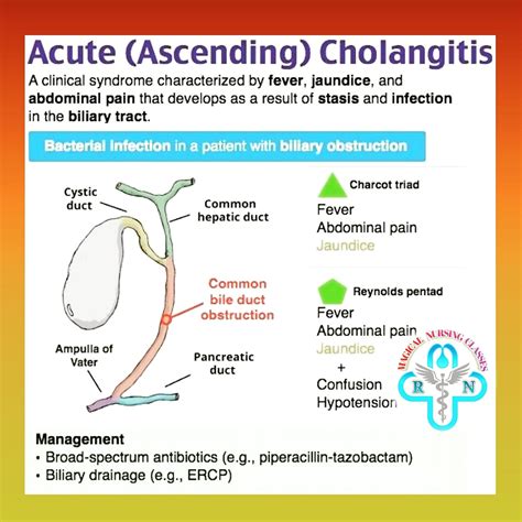 Cholangitis Is An Inflammation Magical Nursing Classes Facebook