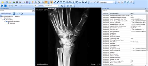 Building A Simple Dicom Application With C And Dcmtk In Visual