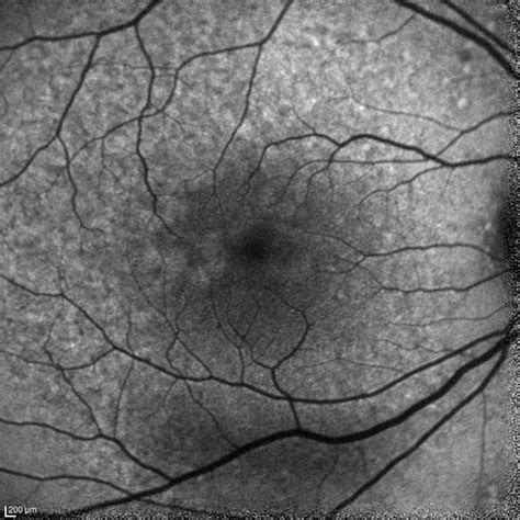 Learn Science Of Amd