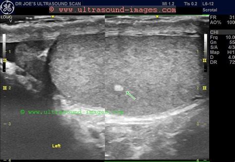 A Gallery Of High Resolution Ultrasound Color Doppler And 3d Images