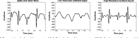 Figure 2 From Patient Specific Seizure Onset Detection Semantic Scholar