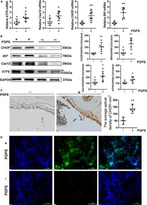 Endoplasmic Reticulum Stress