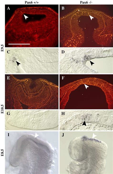 Precocious Retinal Neurons Pax6 Controls Timing Of Differentiation And