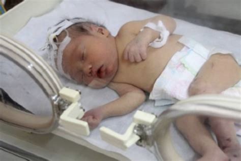 È Nato Ma Non è Né Maschio Né Femmina La Mamma Partorisce Il Suo