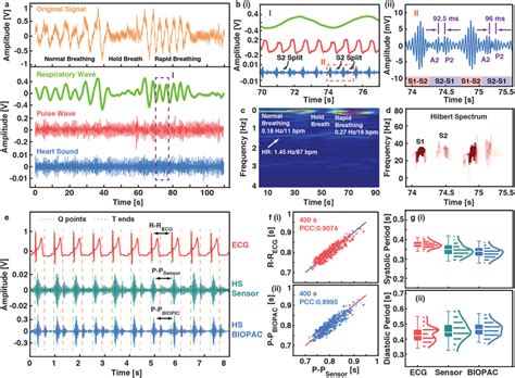 Measurement And Analysis Of Heart Sounds By Placing The Sensor Patch At Download Scientific