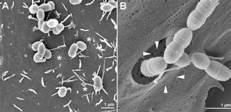 Figure 2 [model For Investigation Of The ] Streptococcus Pyogenes