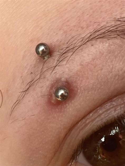 I Think My Eyebrow Piercing Is Really Irritated Im Scared Its An