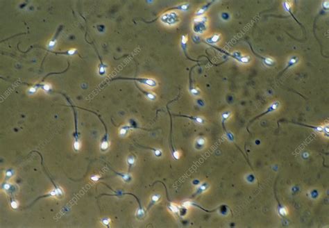 Sperm Under Microscope