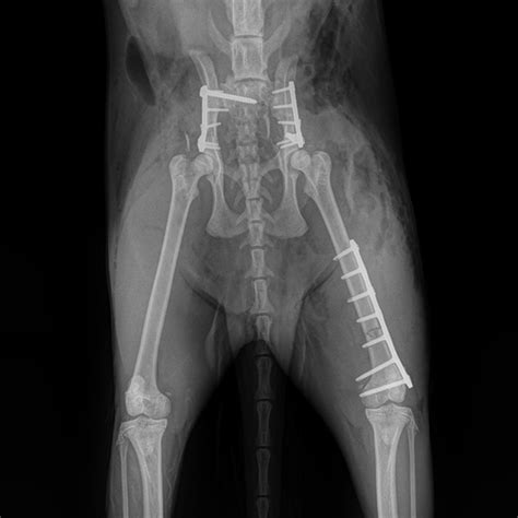 Fracture Management Locking Plates Rita Leibinger