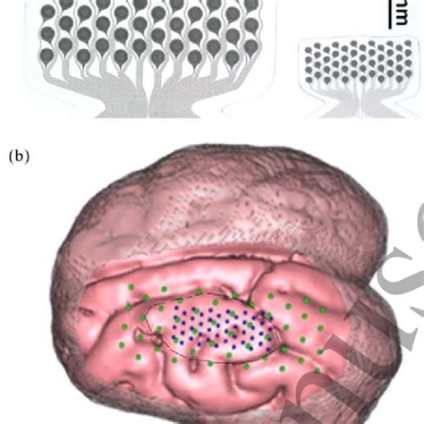 µecog Electrode Array Layout And Positioning On The Cortex A Layouts
