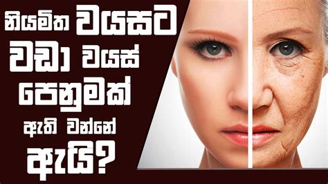 නියමිත වයසට වඩා වයස් පෙනුමක් ඇති වන්නේ ඇයි 11 07 2018 Youtube