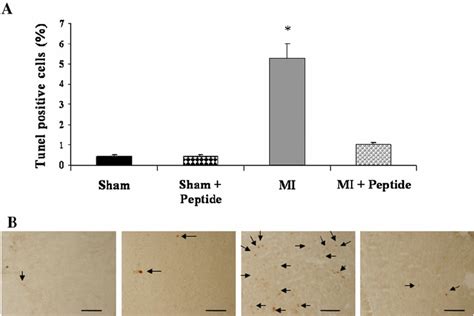 Histological Analysis And Tunel Staining For Apoptosis In Hearts Of