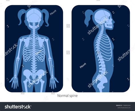 Normal Spine Girl Body Xray Flat Stock Vector Royalty Free 1790092343