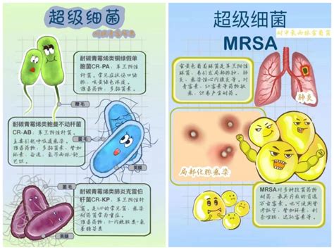 采样拭子在多重耐药菌MDRO主动筛查标本采集方面的常见应用 深圳市美迪科生物医疗科技有限公司