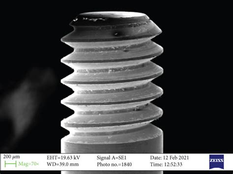 SEM Detail Of The Head Of The Connection Screw A A Force Of 30 N Download Scientific Diagram