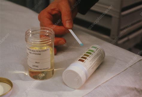 Test For Urine Glucose Level Stock Image M920 0211 Science Photo Library