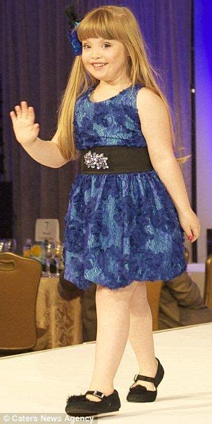 Pin On Up With Downs Syndrome