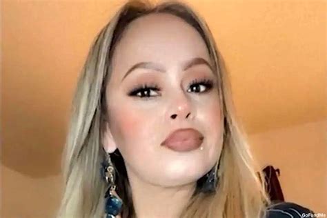 Woman Loses Arms And Legs After Eating Fish Contaminated With Flesh