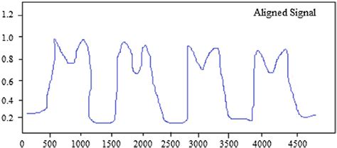 Signal Arrangement Of Foot Movement Utilizing Tw Algorithm Download