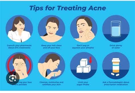 Acne Tips For Managing Health By Muhammad Ibrahim Medium